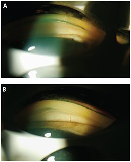 Ophthalmology Management | PentaVision