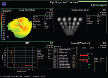 Ophthalmology Management | PentaVision