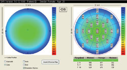 Ophthalmology Management | PentaVision