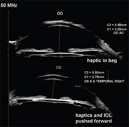 Ophthalmology Management | PentaVision