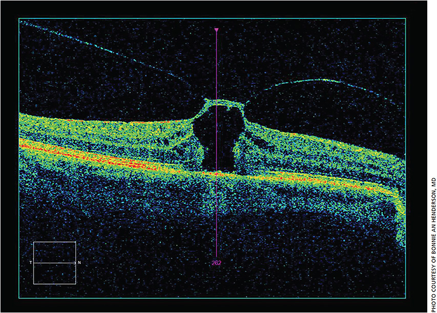 Ophthalmology Management | PentaVision