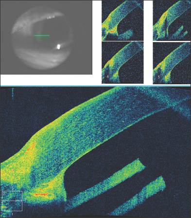 Ophthalmology Management | PentaVision