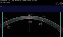 Ophthalmology Management | PentaVision