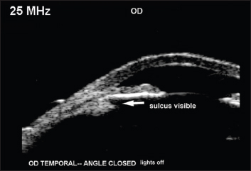 Ophthalmology Management | PentaVision