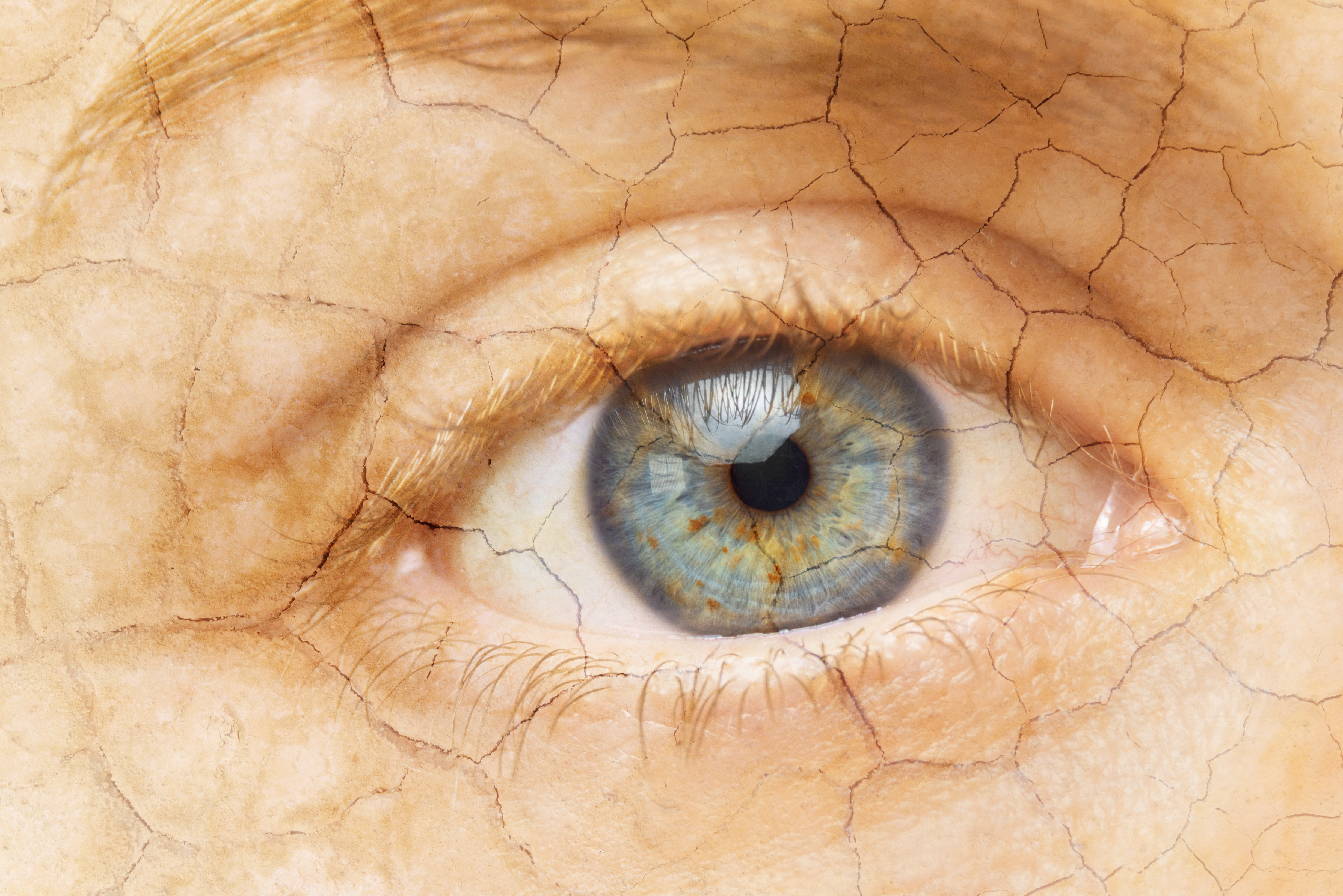 Serum Tears in the Treatment of Dry Eye and Ocular Surface Disease ...