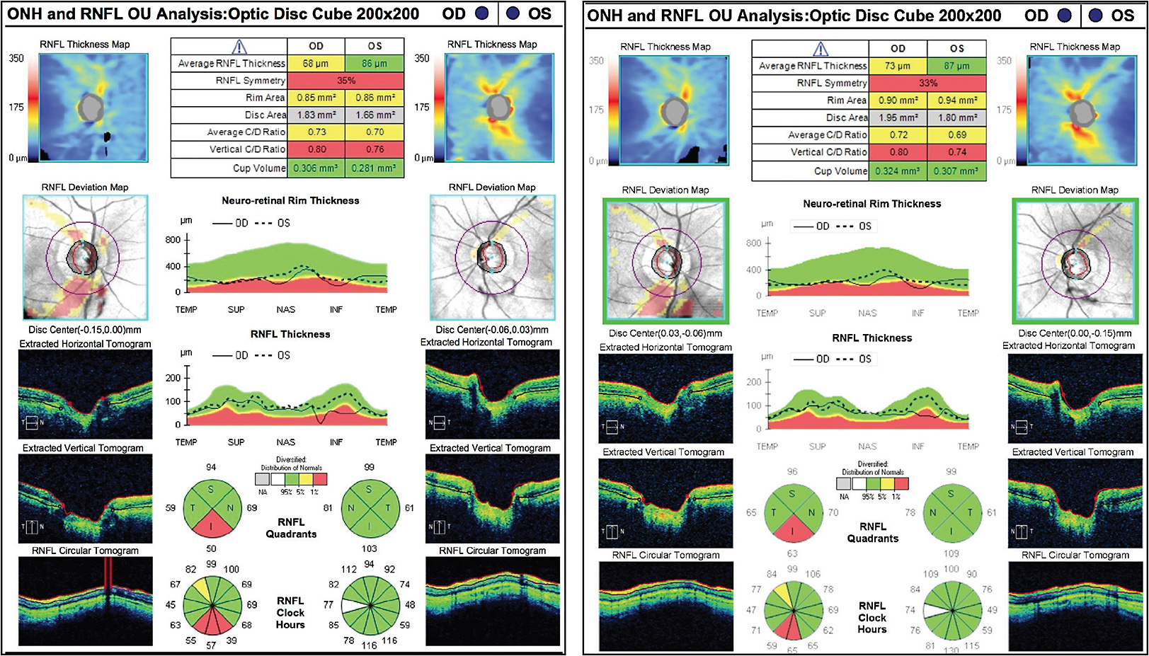 Ophthalmology Management | PentaVision