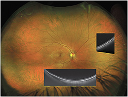 Ophthalmology Management | PentaVision