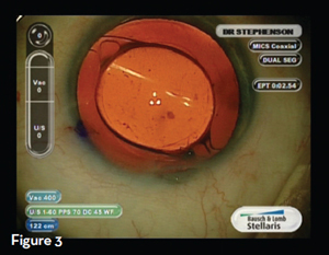 Ophthalmology Management | PentaVision