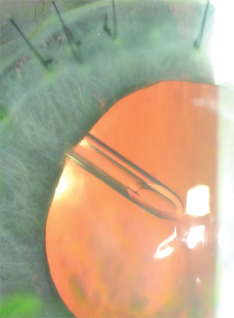 Ophthalmology Management | PentaVision