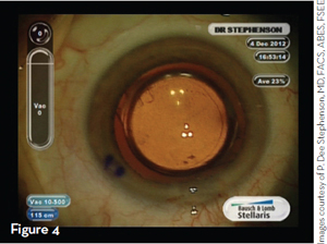 Ophthalmology Management | PentaVision