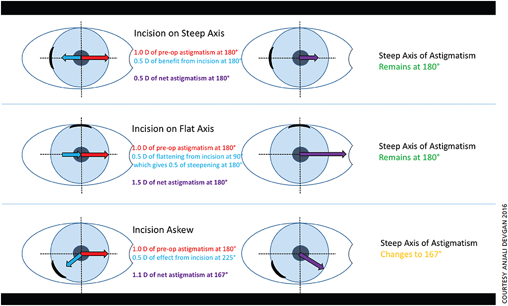 Ophthalmology Management | PentaVision