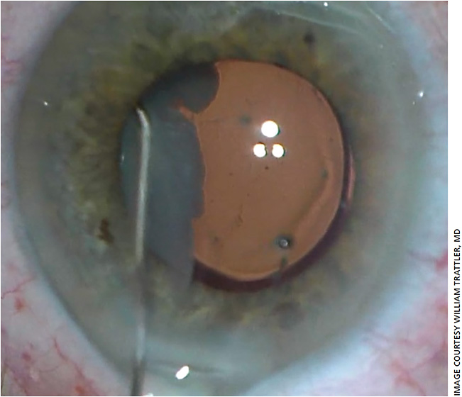 Ophthalmology Management | PentaVision