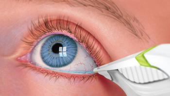Ophthalmology Management | PentaVision