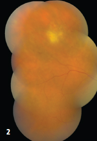 Ophthalmology Management | PentaVision