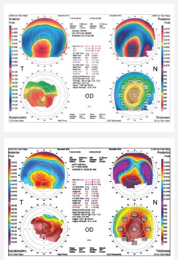 Ophthalmology Management | PentaVision