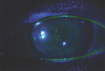 Ophthalmology Management | PentaVision