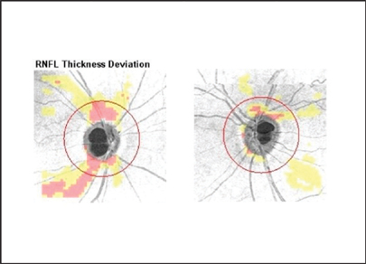 Ophthalmology Management | PentaVision