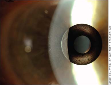 Ophthalmology Management | PentaVision