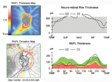 Ophthalmology Management | PentaVision