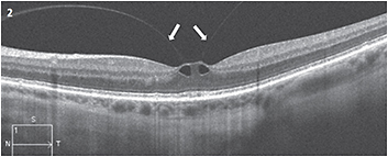 Ophthalmology Management | PentaVision