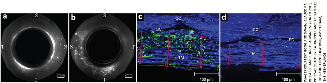 Ophthalmology Management | PentaVision