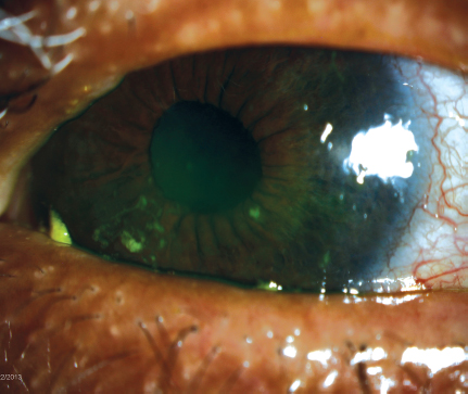 Ophthalmology Management | PentaVision