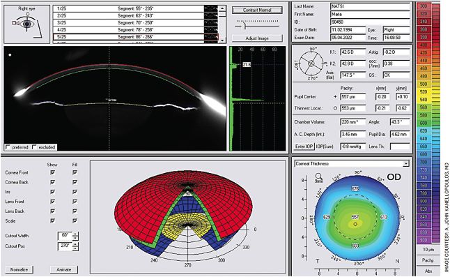 Ophthalmology Management | PentaVision