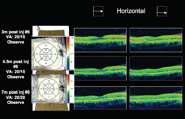 Ophthalmology Management | PentaVision