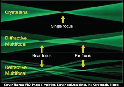 Ophthalmology Management | PentaVision