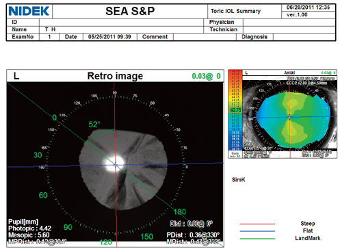 Ophthalmology Management | PentaVision