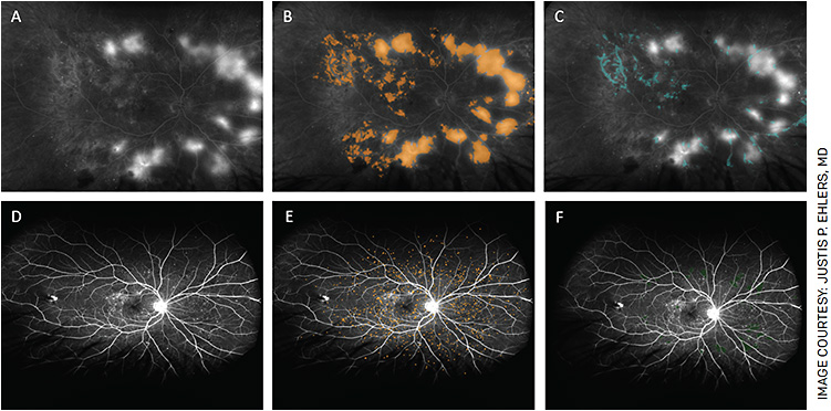 Ophthalmology Management | PentaVision