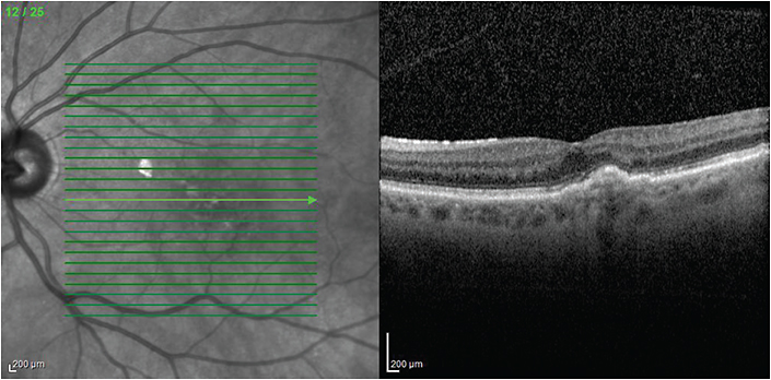 Ophthalmology Management | PentaVision
