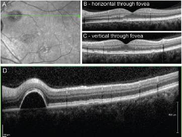 Ophthalmology Management | PentaVision