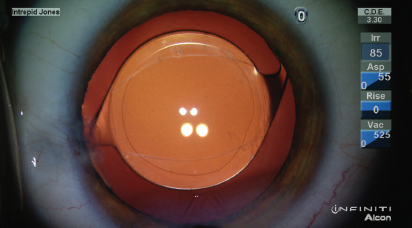 Ophthalmology Management | PentaVision