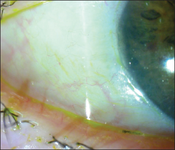 Ophthalmology Management | PentaVision