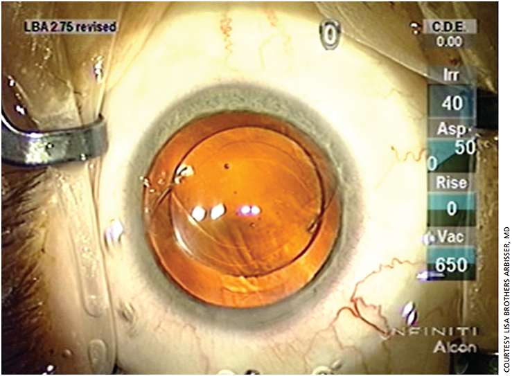 Ophthalmology Management | PentaVision