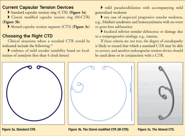 Ophthalmology Management | PentaVision