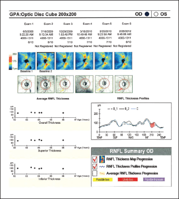 Ophthalmology Management | PentaVision