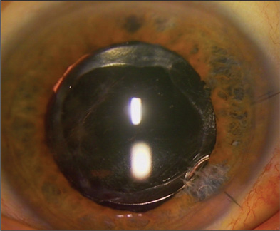 Ophthalmology Management | PentaVision