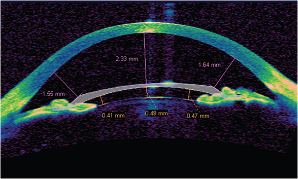 Ophthalmology Management | PentaVision