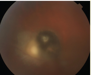 Ophthalmology Management | PentaVision