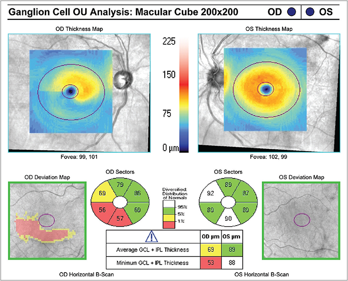Ophthalmology Management | PentaVision