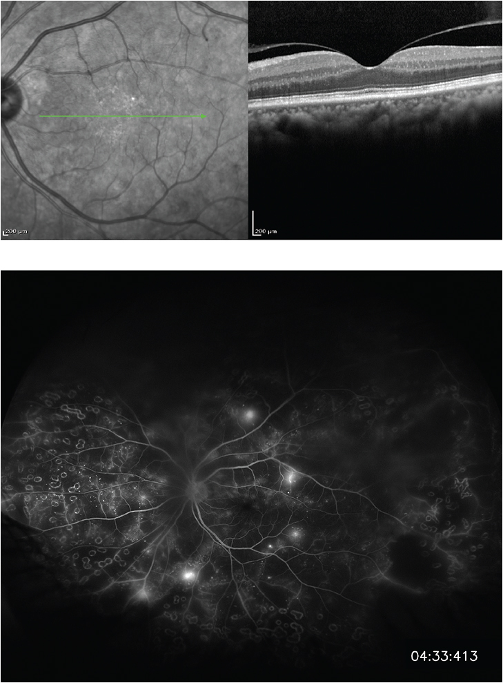 Ophthalmology Management | PentaVision