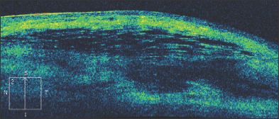 Ophthalmology Management | PentaVision