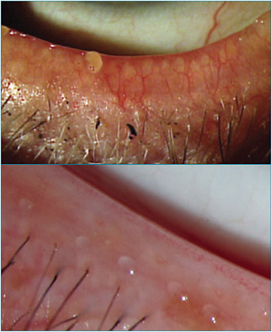 Ophthalmology Management | PentaVision
