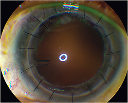 Ophthalmology Management | PentaVision
