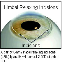 Ophthalmology Management | PentaVision