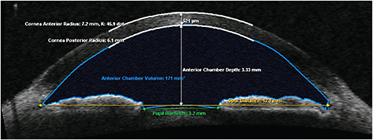 Ophthalmology Management | PentaVision