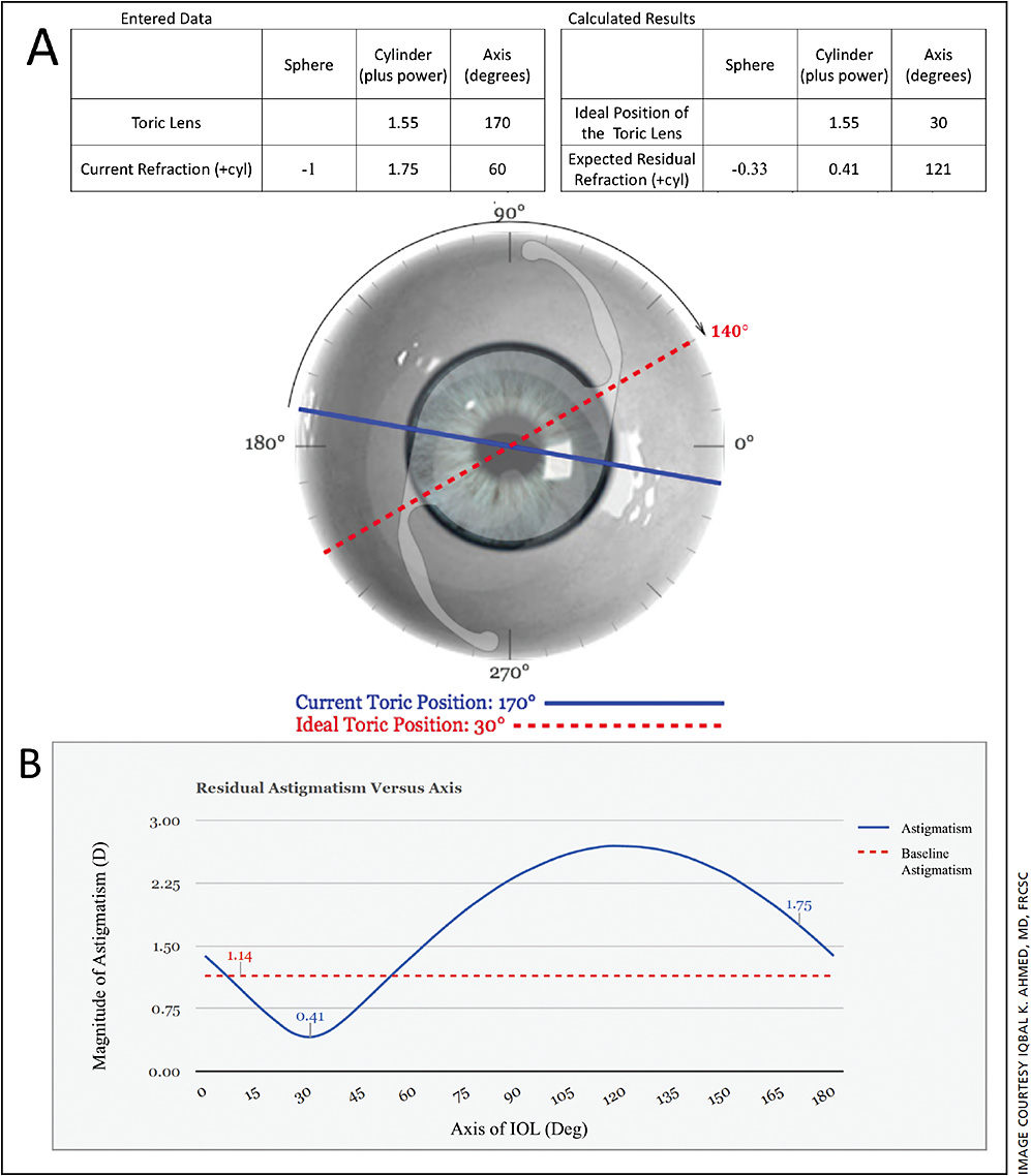 Ophthalmology Management | PentaVision