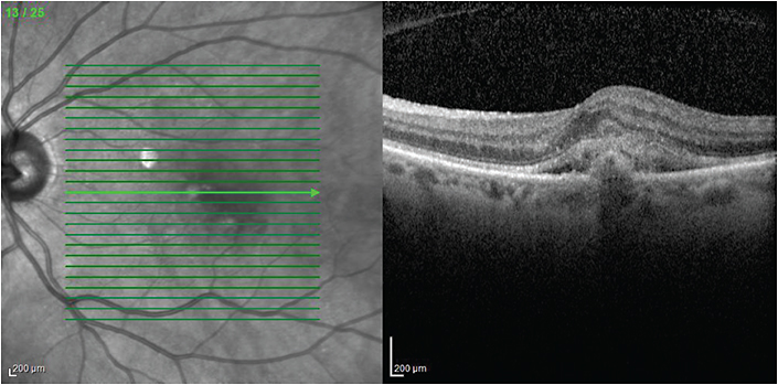 Ophthalmology Management | PentaVision